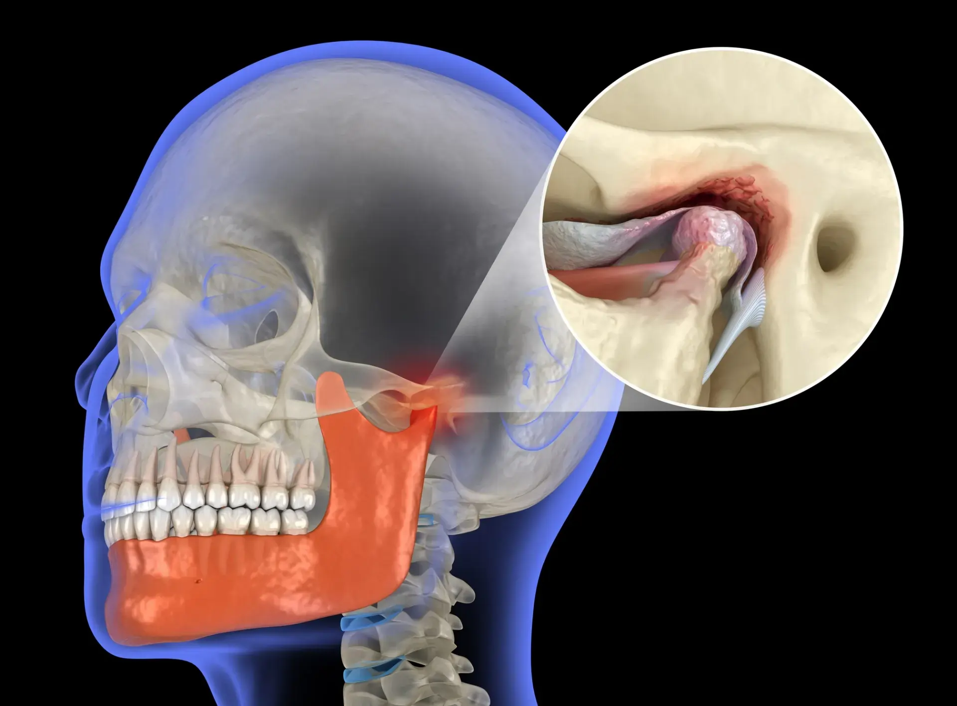 TMJ Dysfunction Physiotherapy Surrey | Beyond Physiotherapy